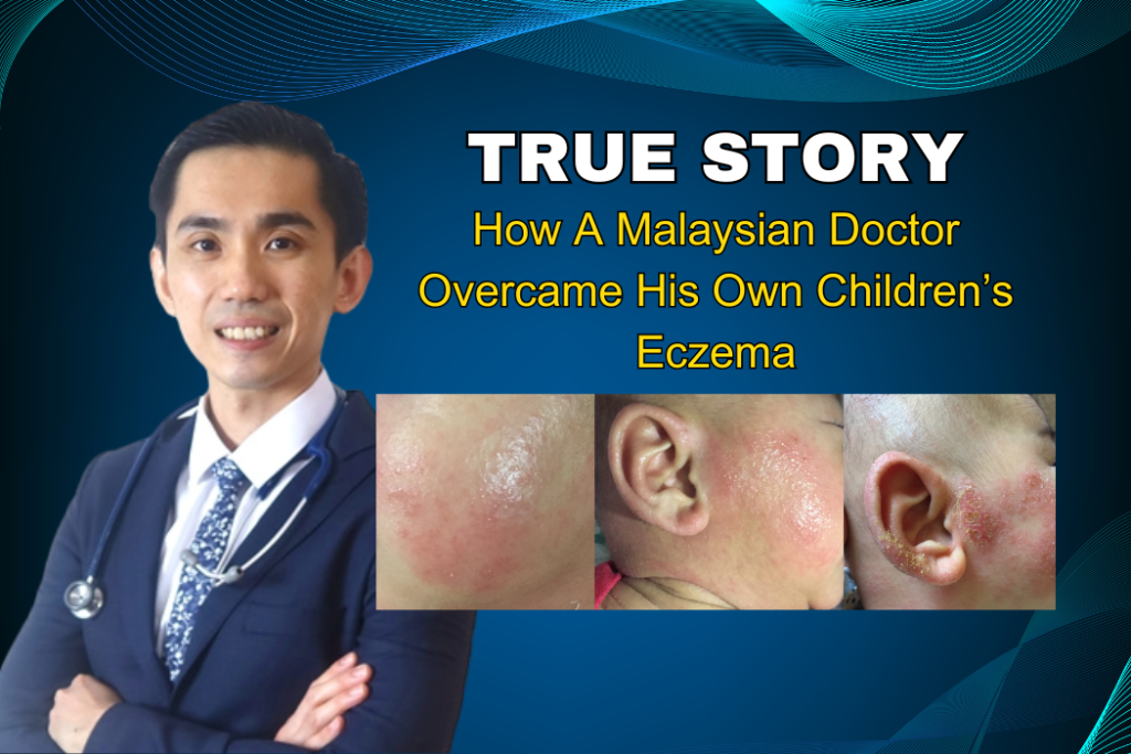 TRUE STORY: How A Malaysian Doctor Overcame His Own Children’s Eczema